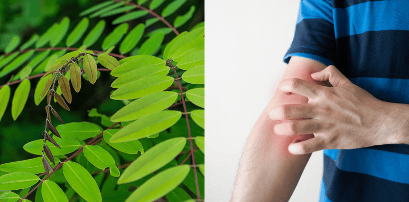 Daun Gelenggang Boleh Rawat Kurap! Ada 5 Lagi Khasiat Daun Ini