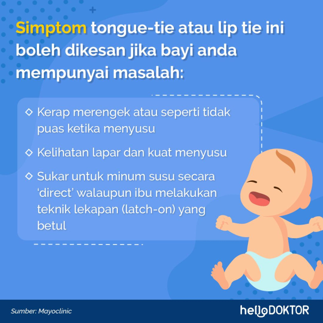 Lidah Bayi Normal Vs Tongue Tie? Ibu Ayah, Ikut Cara Ini Cek Lidah Anak!