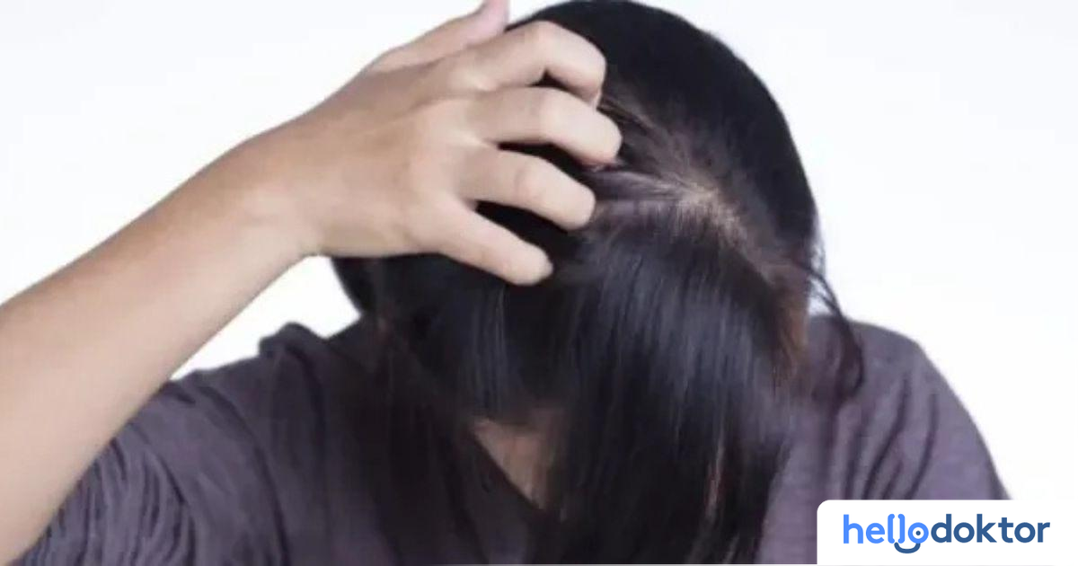 Shampoo Untuk Kulit Kepala Gatal, Bahan Apa Yang Kena Ada Di Dalam?