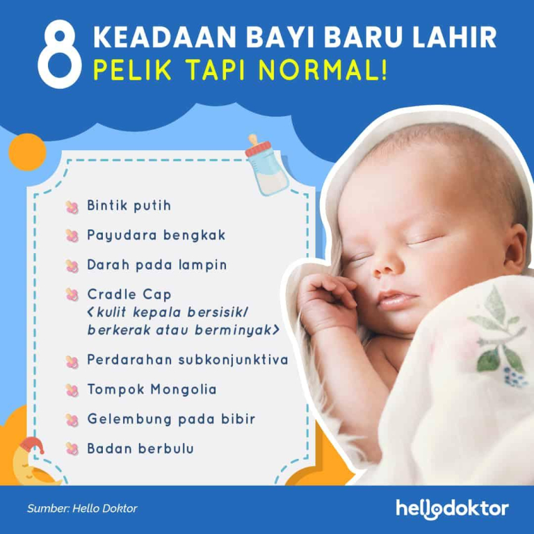 Kaki Bayi Bengkok, Mama Papa Ikut 9 Cara Urutan Ini Untuk Luruskannya!