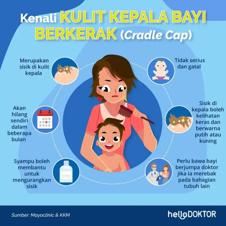 Cara Hilangkan Ruam Di Muka Bayi Dengan 7 Petua Semula Jadi