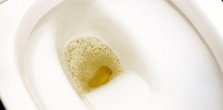 Tanda Buah Pinggang Rosak: Boleh MAUT Jika Tidak Segera Dirawat!