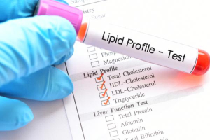 Bacaan Gula Normal Untuk Dewasa: Buat Ujian Ini Untuk Kesan Diabetes