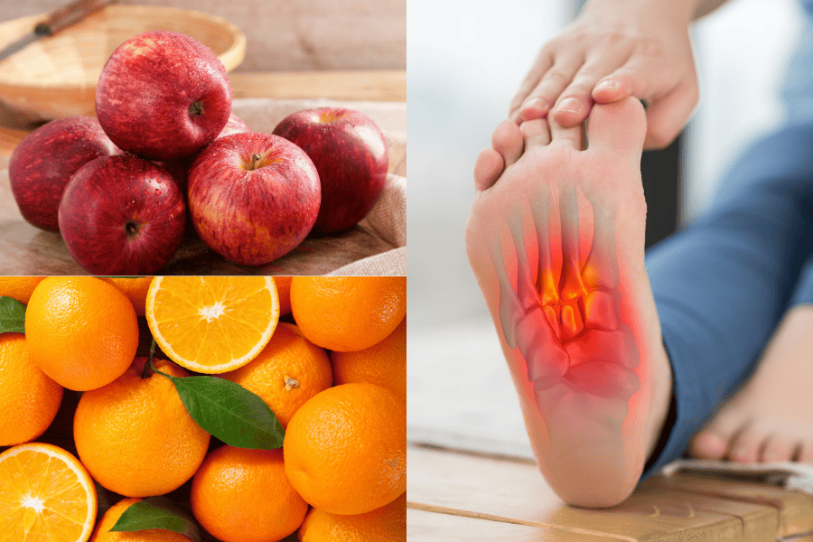 Makanan Yang Dapat Menurunkan Asid Urik, Penting Kalau Ada Gout!