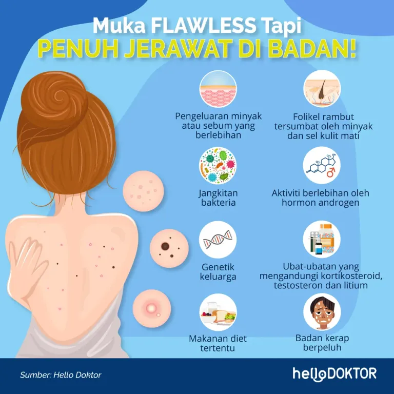 Ubat Gatal Kulit Terbaik Tahun Ini! Terbukti Berkesan & Ramai Yang Guna!