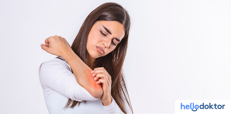 Ubat Gatal Kulit Terbaik Tahun Ini! Terbukti Berkesan & Ramai Yang Guna!