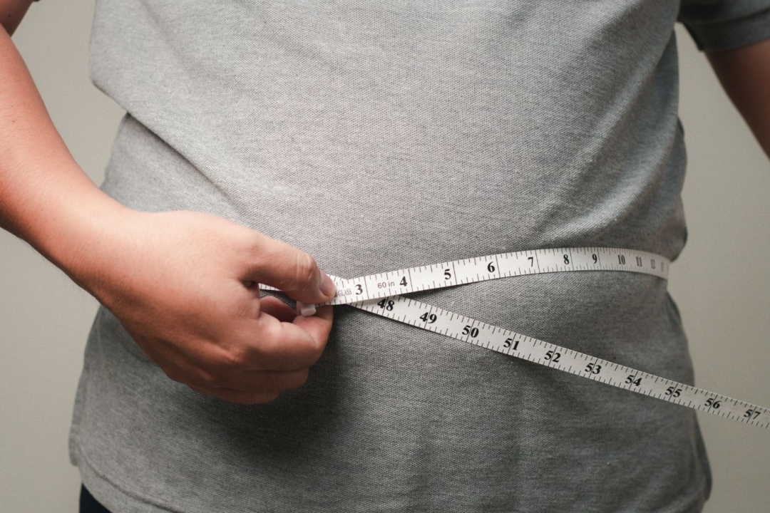 Definisi Obesiti & Solusi Pakar Untuk Gaya Hidup Lebih Sihat